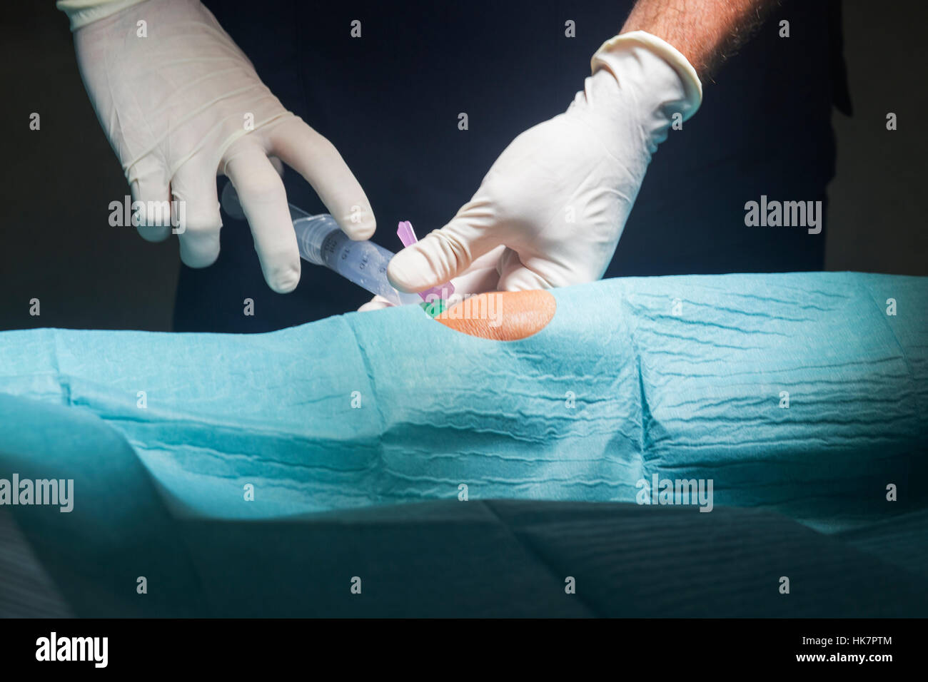 Anaesthtist anaesthetic injection in knee for surgery hospital ...