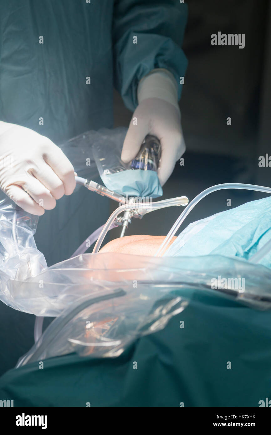 Knee keyhole surgery hospital arthroscopy operation medical procedure ...