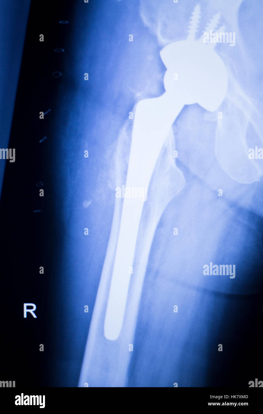 Ball socket joint anatomy hi-res stock photography and images - Alamy