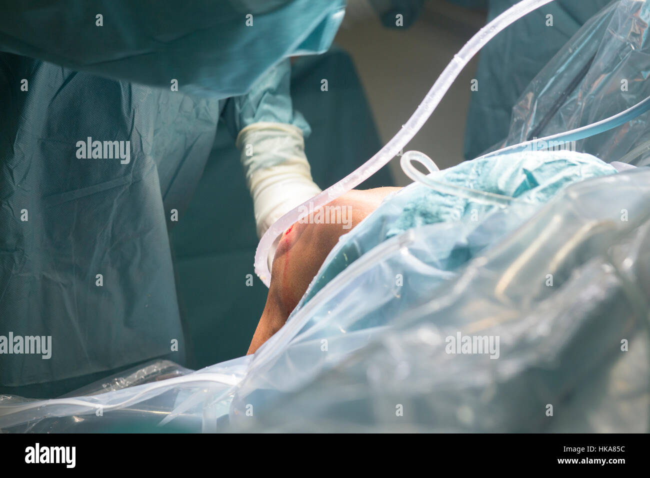 Hospital surgery operating theater emergency room surgical procedure ...