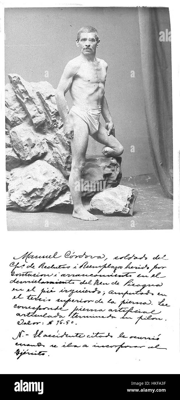 Mutilado en la GdP 31 Stock Photo - Alamy