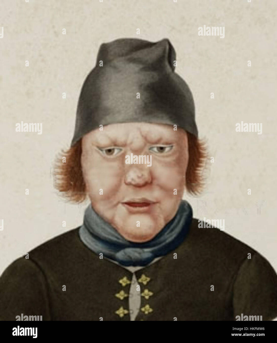 This poignant 1851 artwork depicts a female leper from Iceland ...