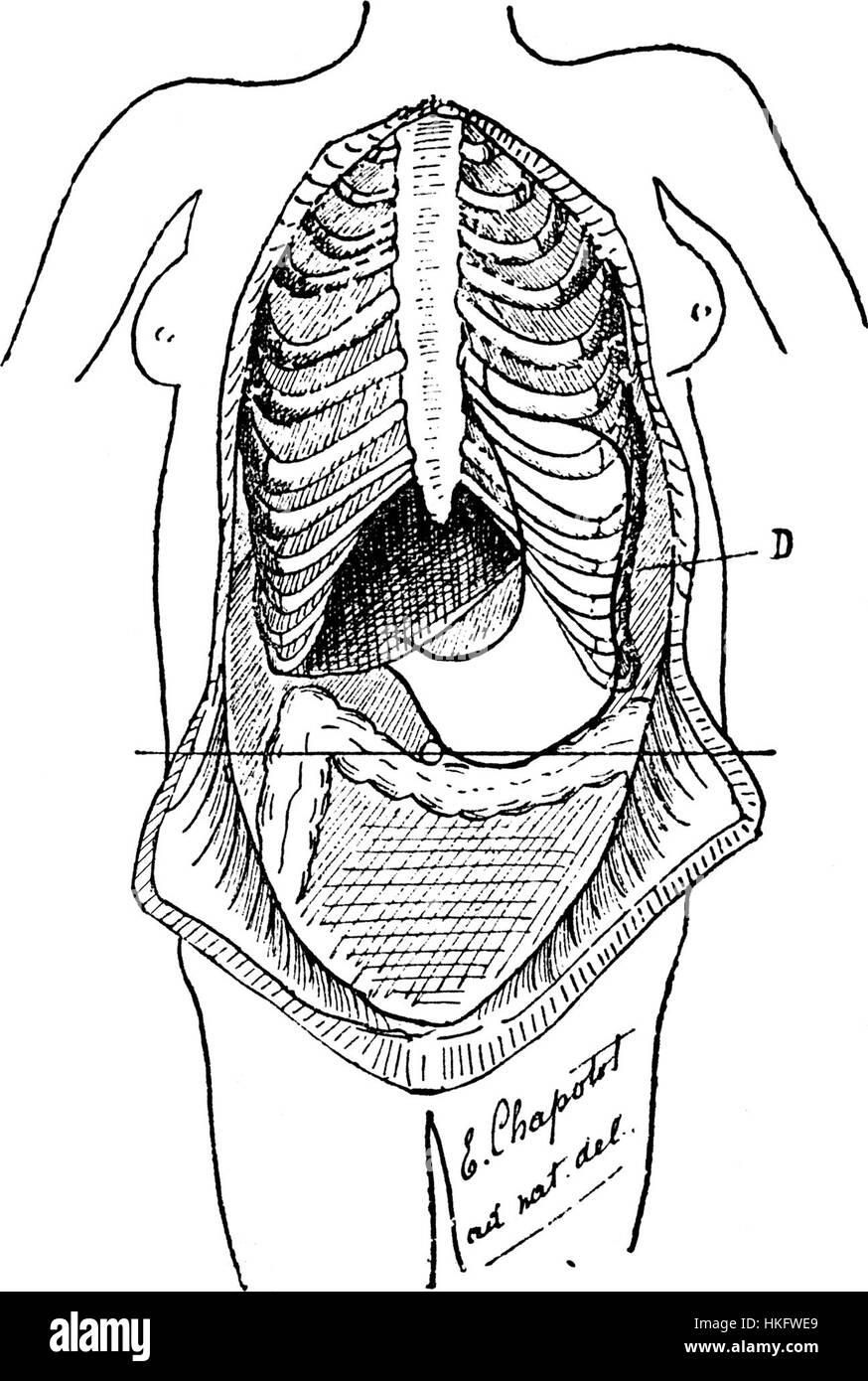 This artwork, titled 'EstomacCorset,' explores the anatomical and ...