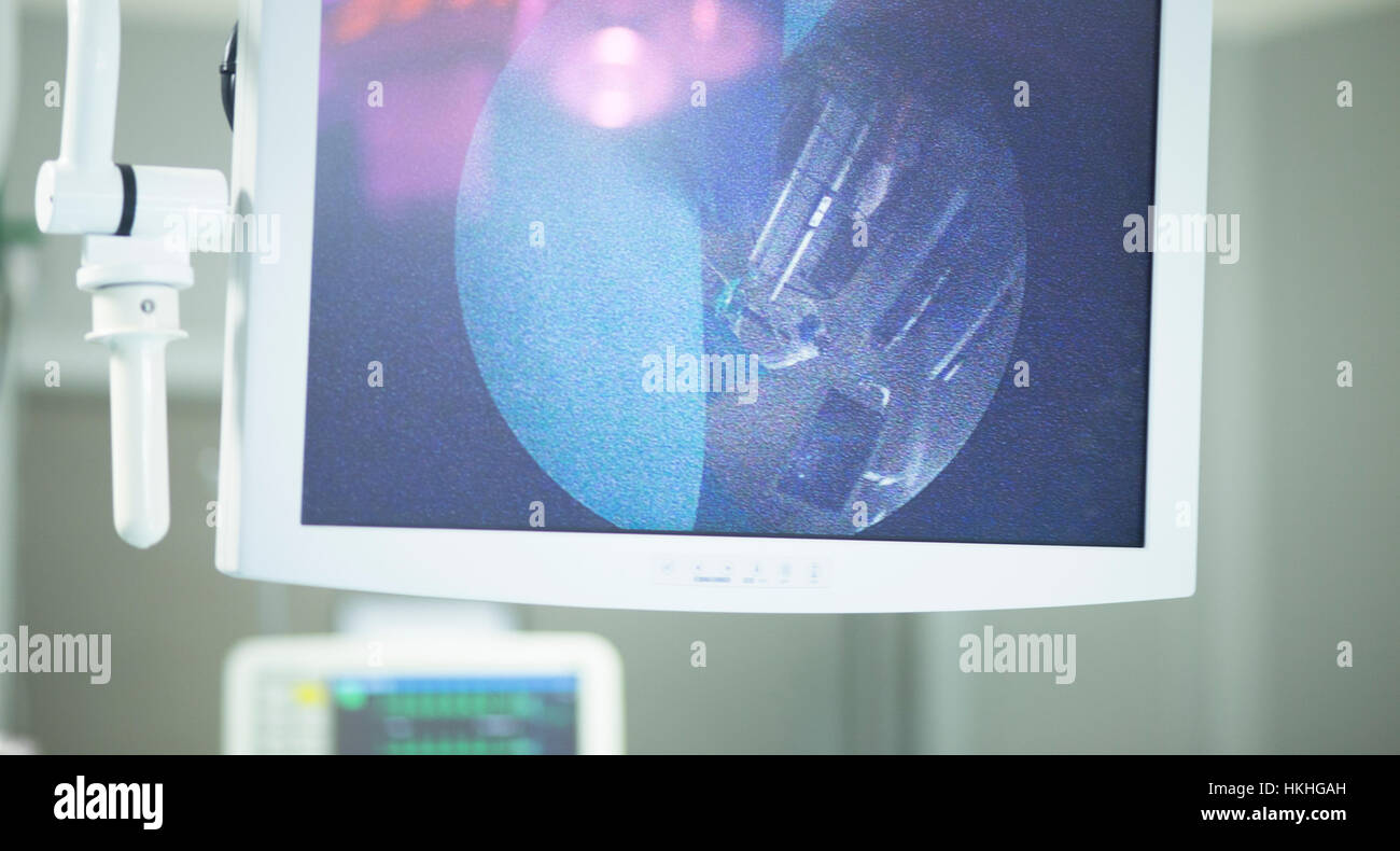 Hospital ward emergency room operating theater and modern equipment ...