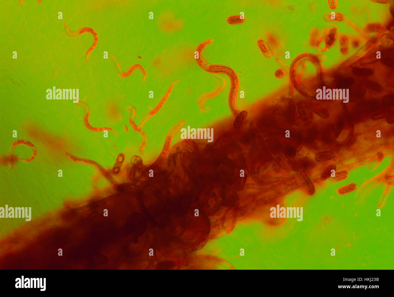 Agriculture - Root Lesion Nematodes (Pratylenchus neglectus) swimming ...
