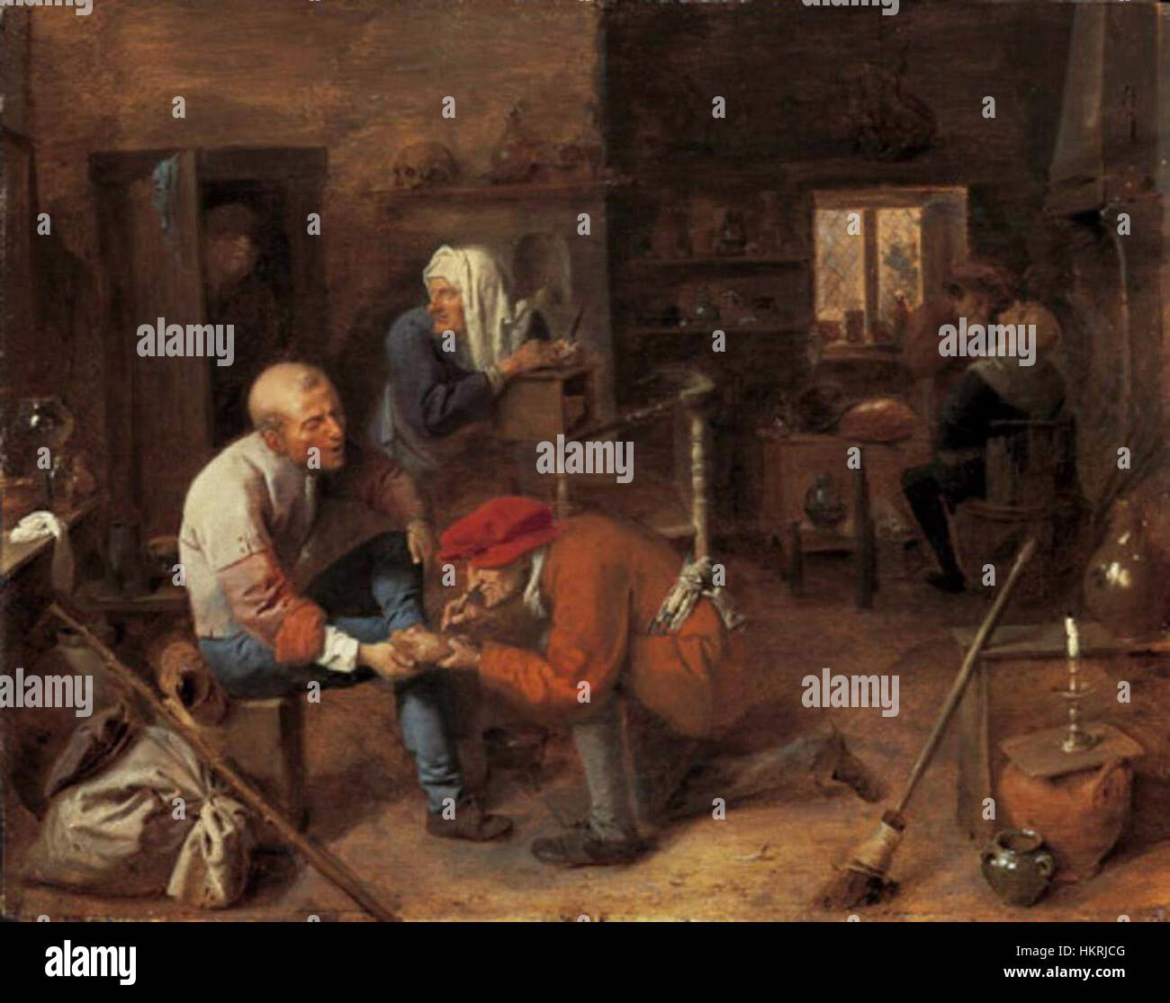 *Adriaen Brouwer*’s *The Operation* depicts a 17th-century medical ...