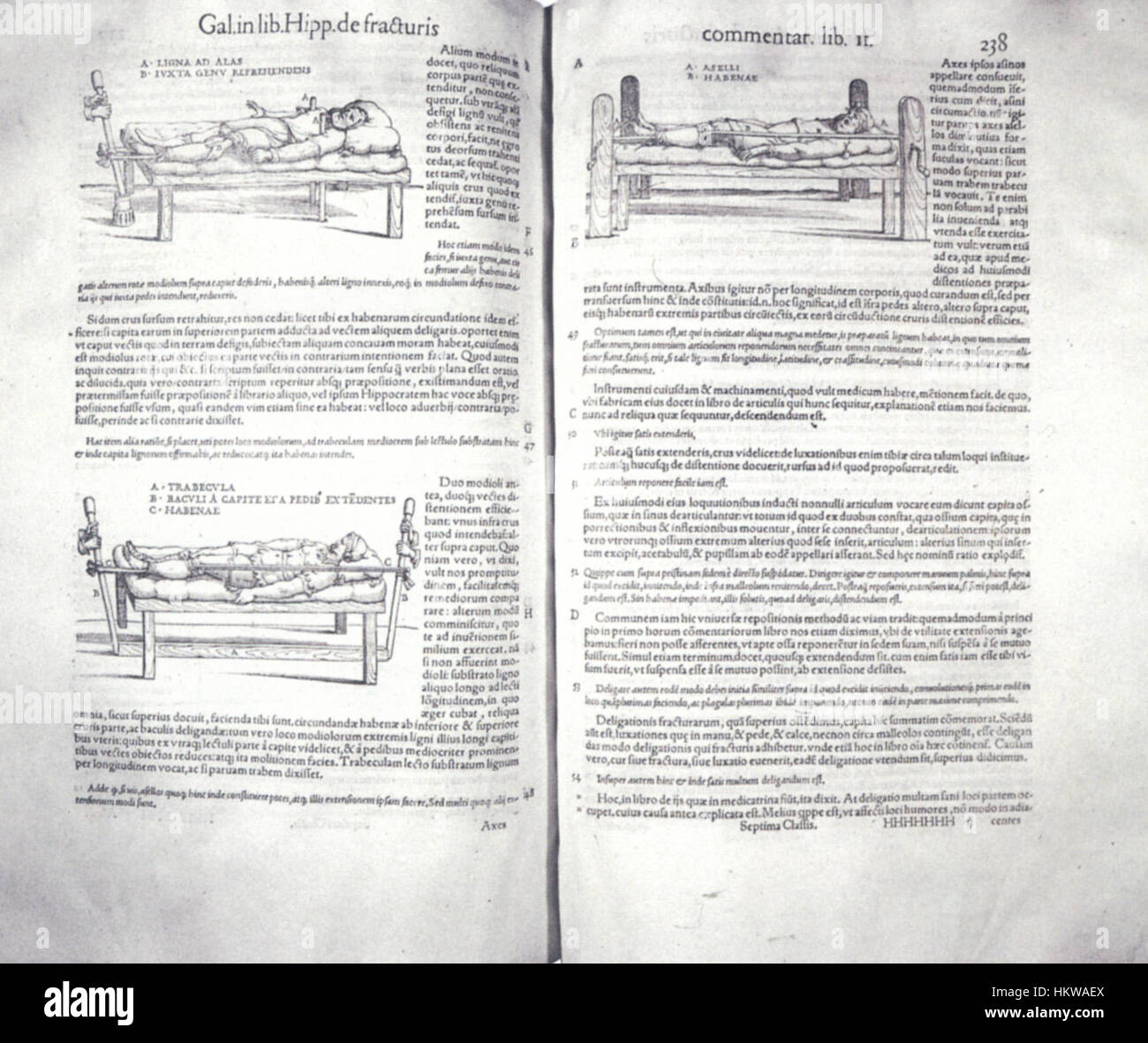 This image depicts a page from *Galen's Opera*, a 1550 Venice edition ...