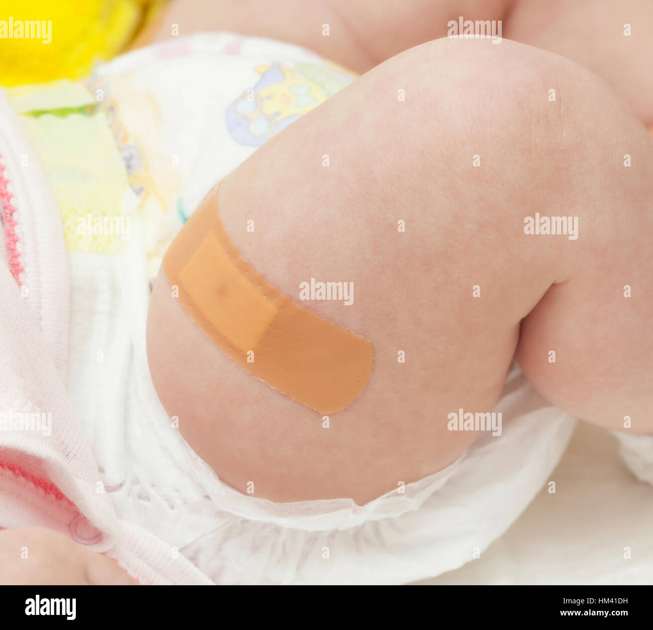 Details of the leg of a newborn with the patch after vaccination Stock ...