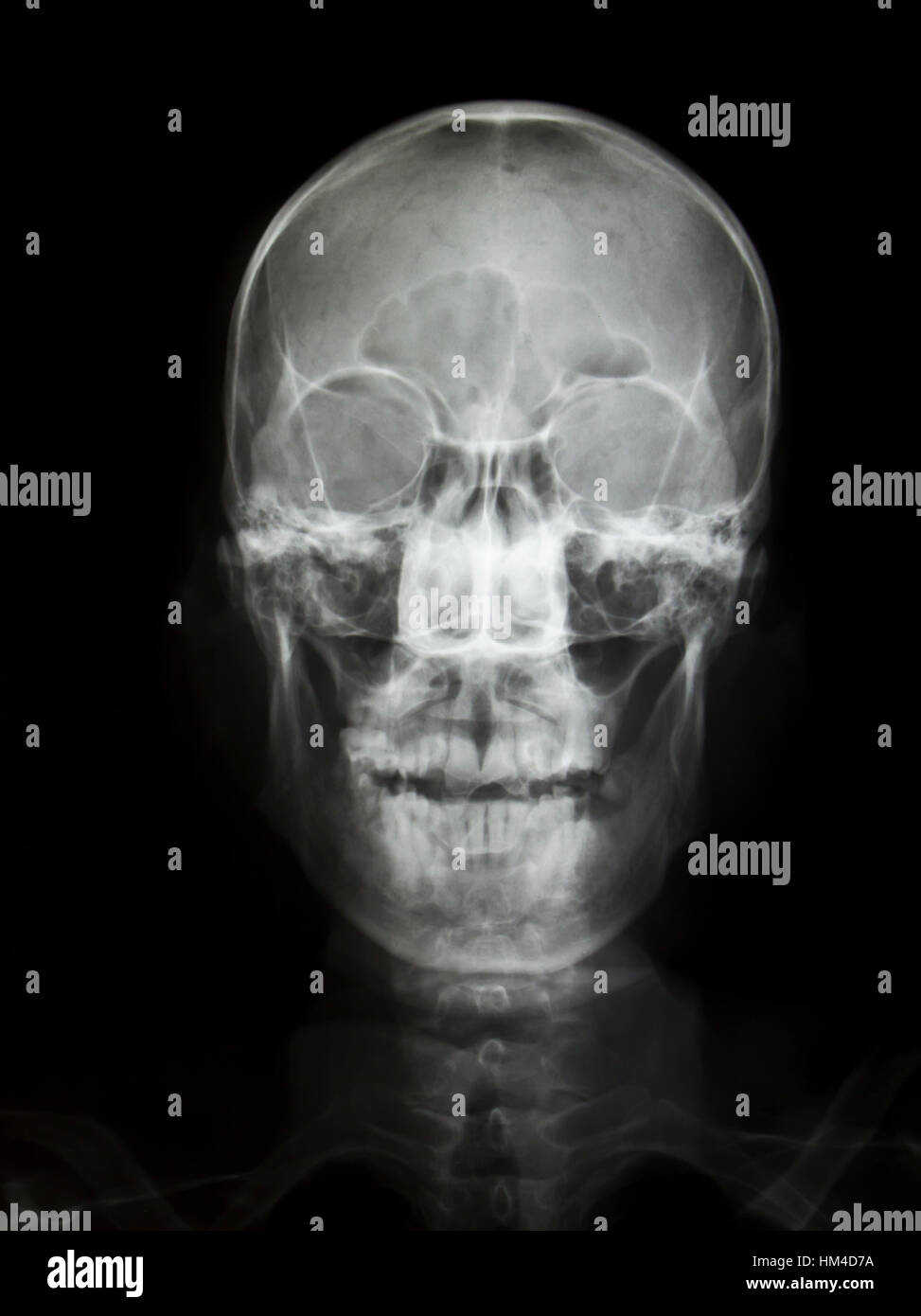 Segment Of Face High Resolution Stock Photography and Images - Alamy