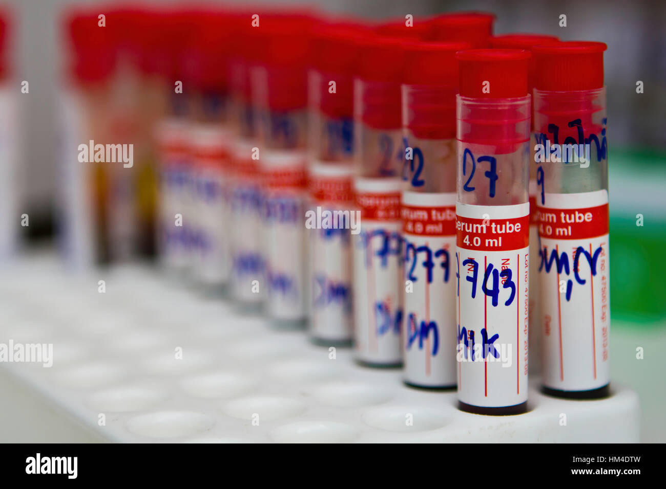 many test tubes with blood being tested Stock Photo - Alamy