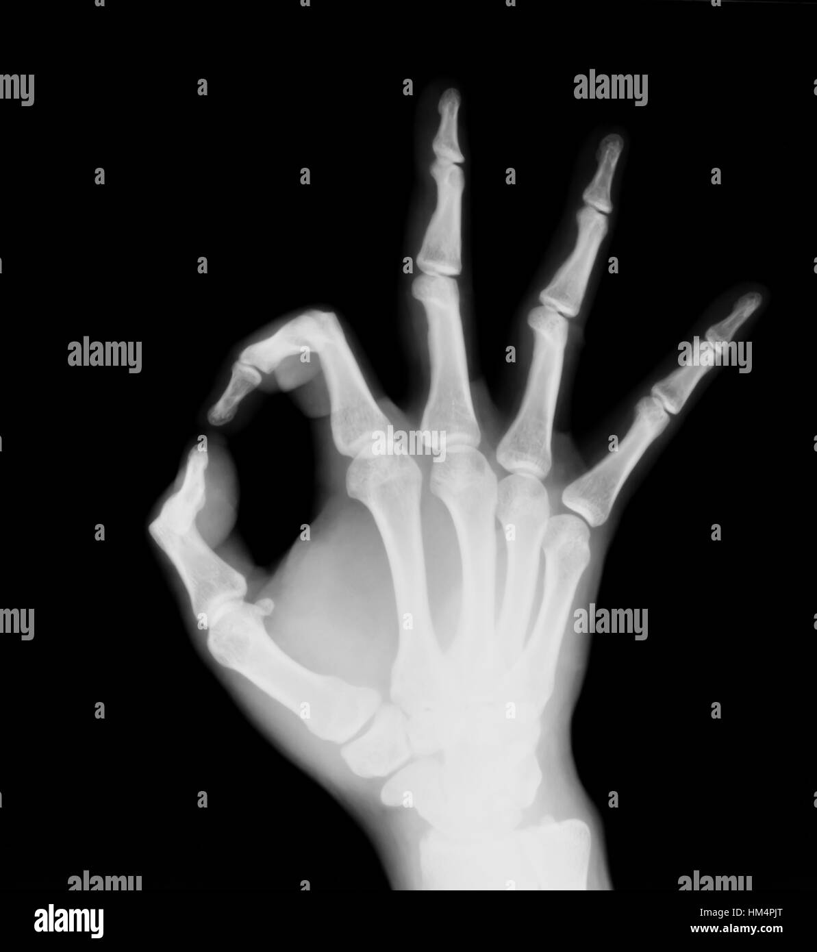 Hand xray image medical background Black and White Stock Photos ...