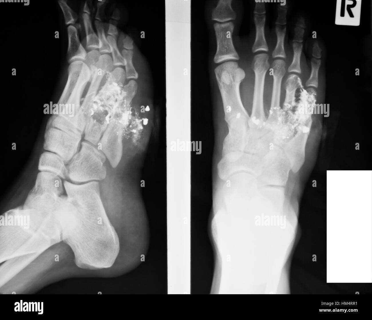 collection of x-ray Stock Photo - Alamy