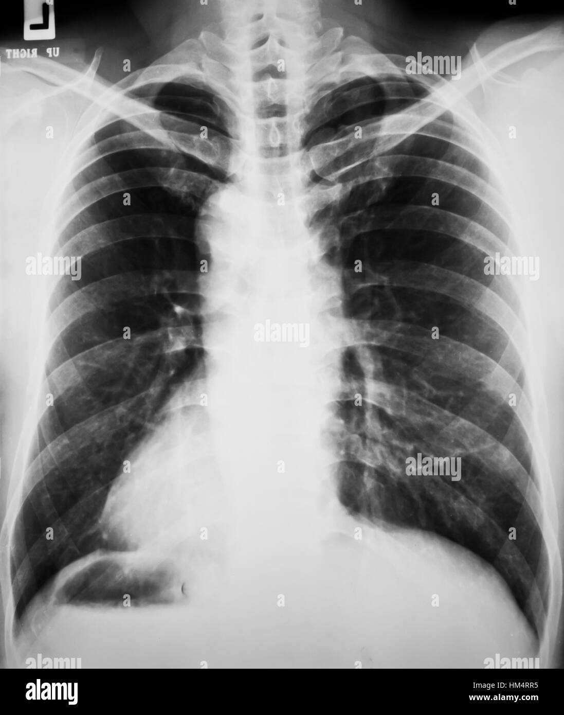 collection of x-ray Stock Photo - Alamy