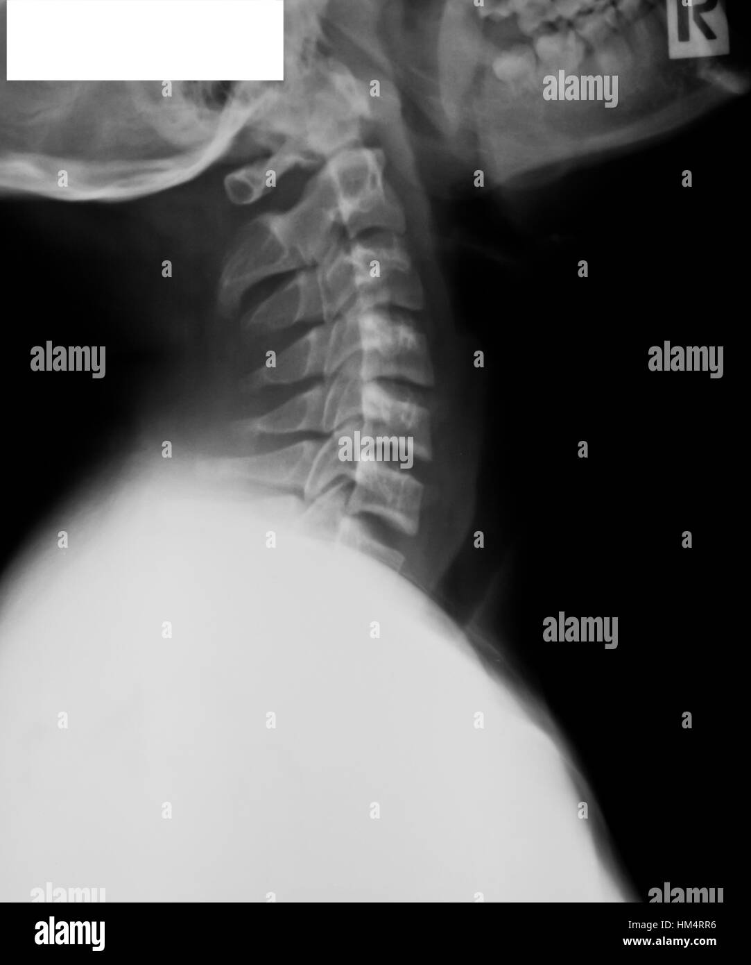 collection of x-ray Stock Photo - Alamy