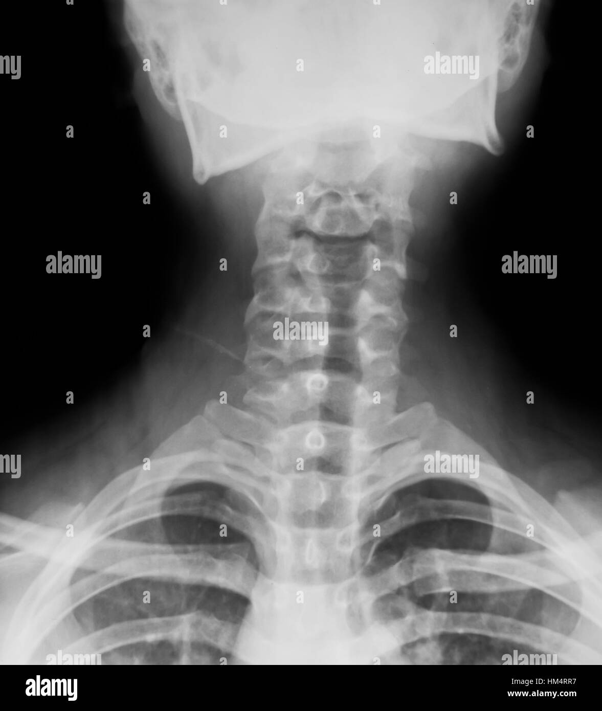 collection of x-ray Stock Photo - Alamy