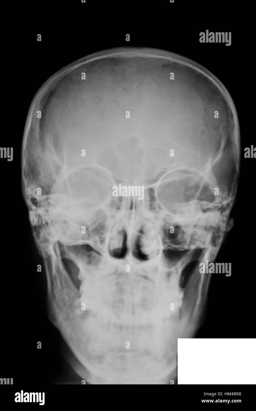 collection of x-ray Stock Photo - Alamy