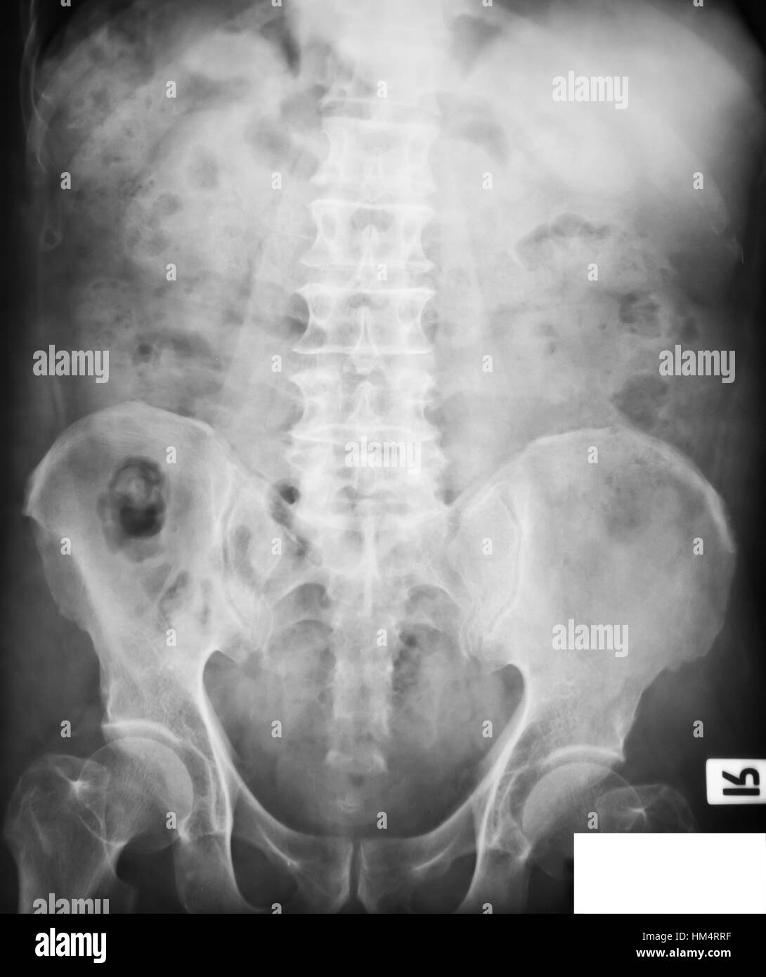 collection of x-ray Stock Photo - Alamy