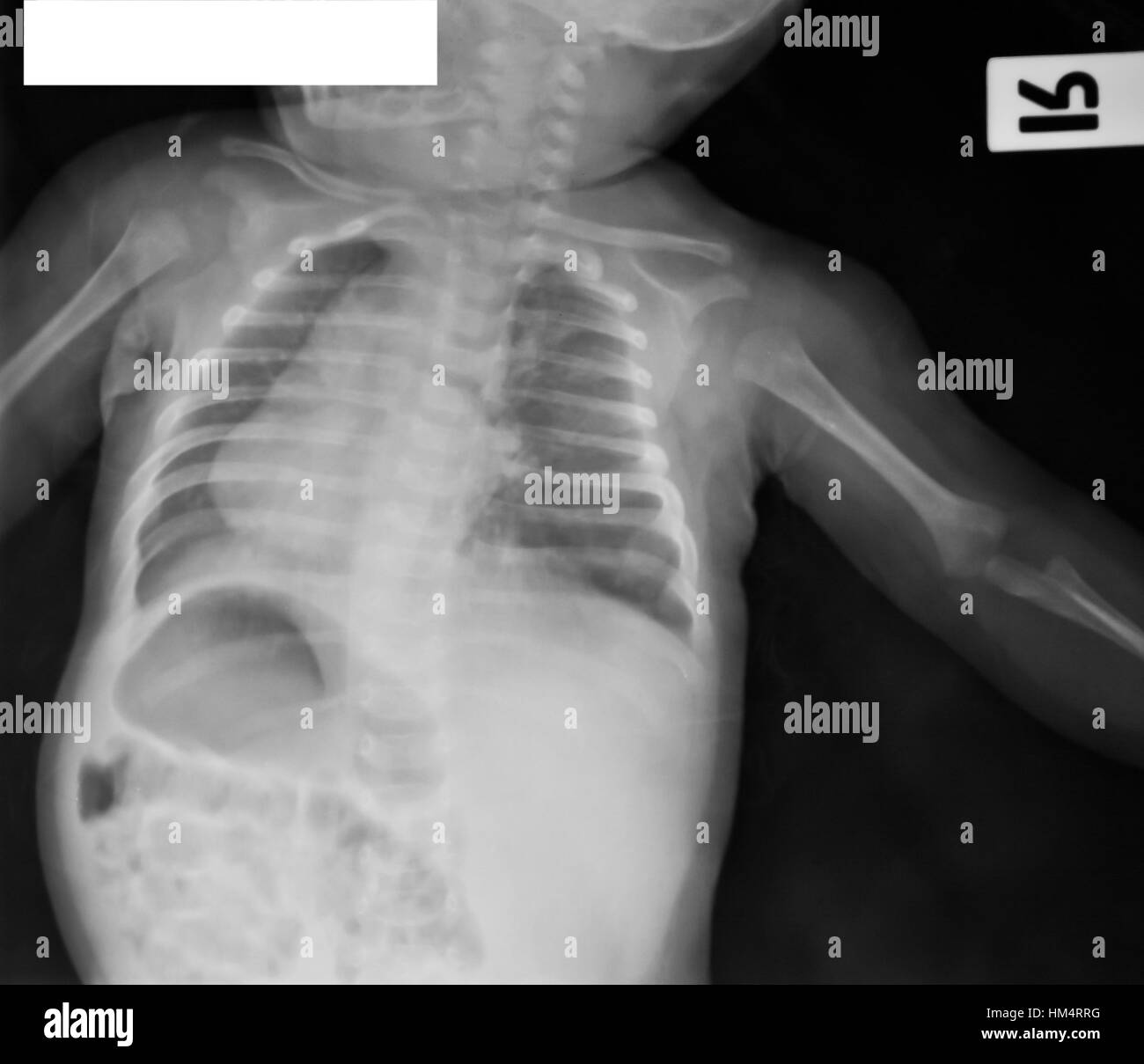 collection of x-ray Stock Photo - Alamy