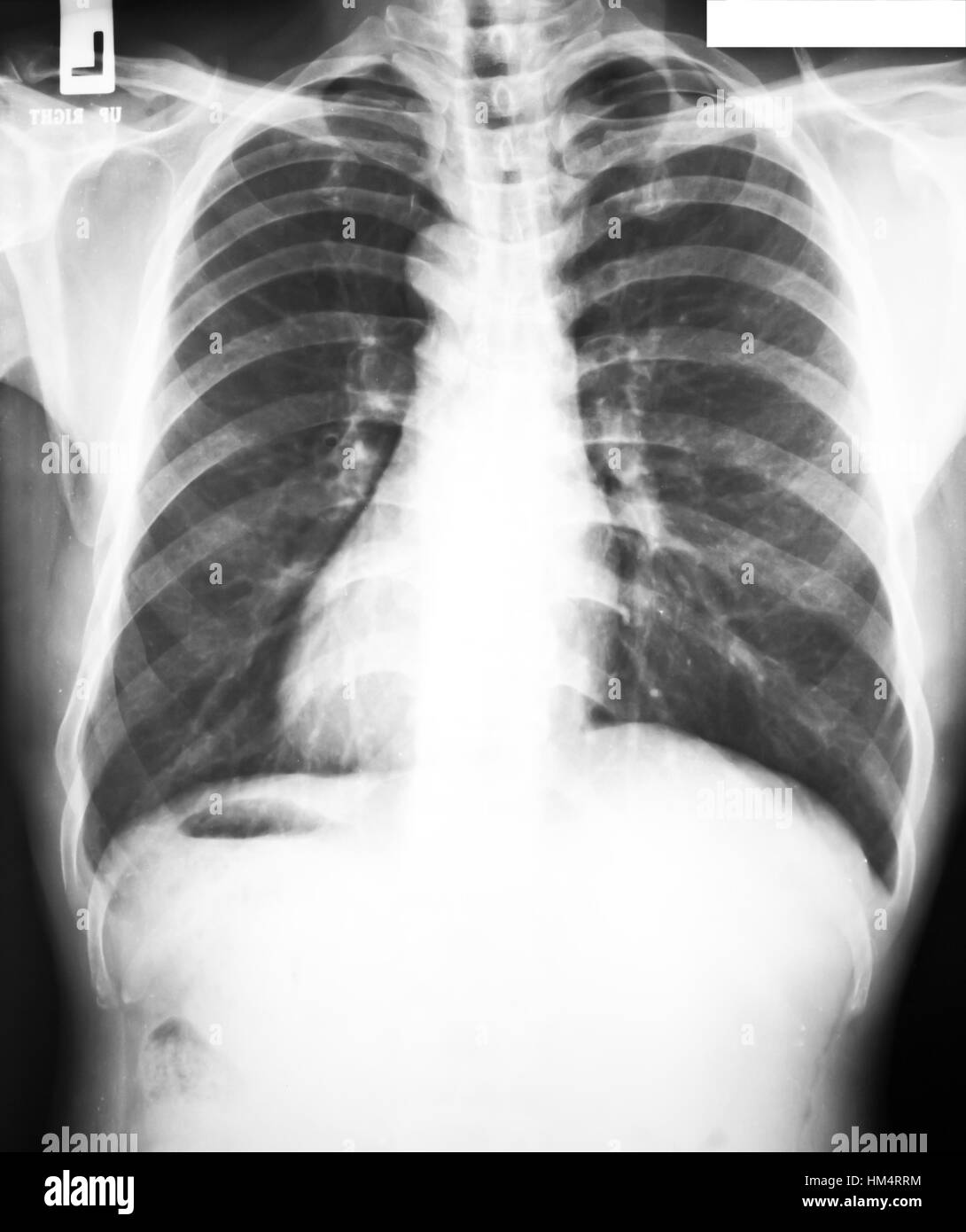 collection of x-ray Stock Photo - Alamy