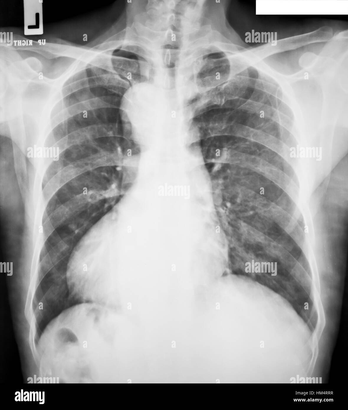 collection of x-ray Stock Photo - Alamy