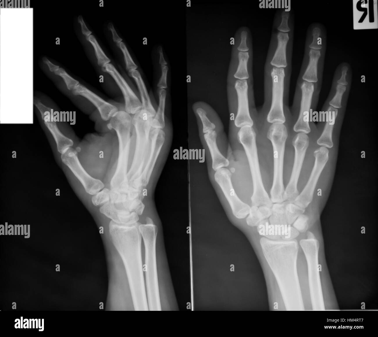 collection of x-ray Stock Photo - Alamy