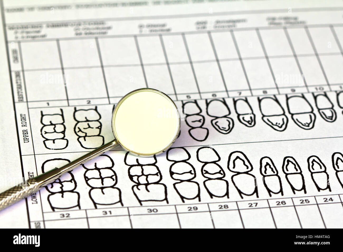 Dental tools and equipment on dental chart Stock Photo - Alamy