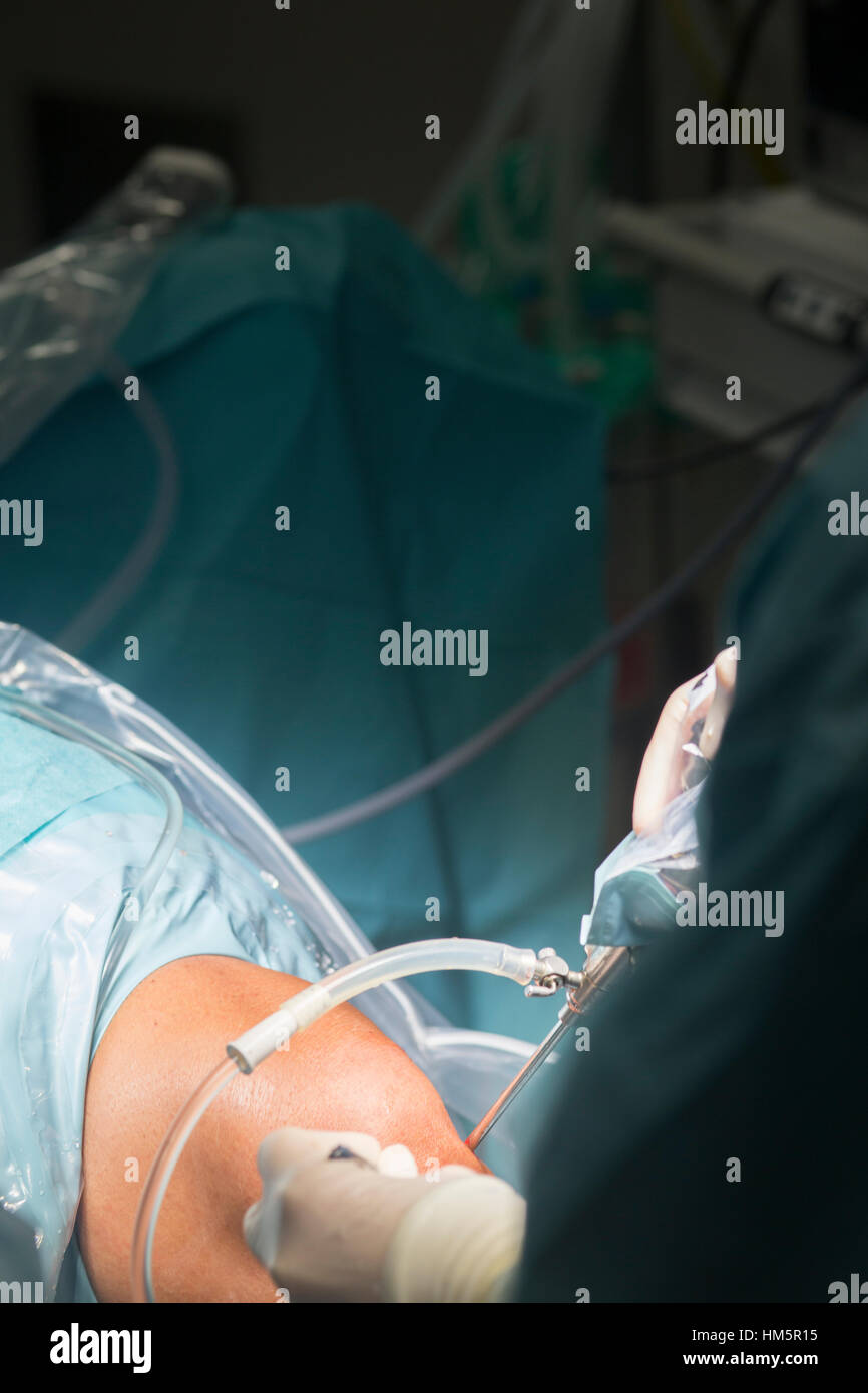 Knee keyhole surgery hospital arthroscopy operation medical procedure ...