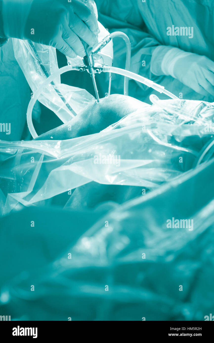 Knee keyhole surgery hospital arthroscopy operation medical procedure ...