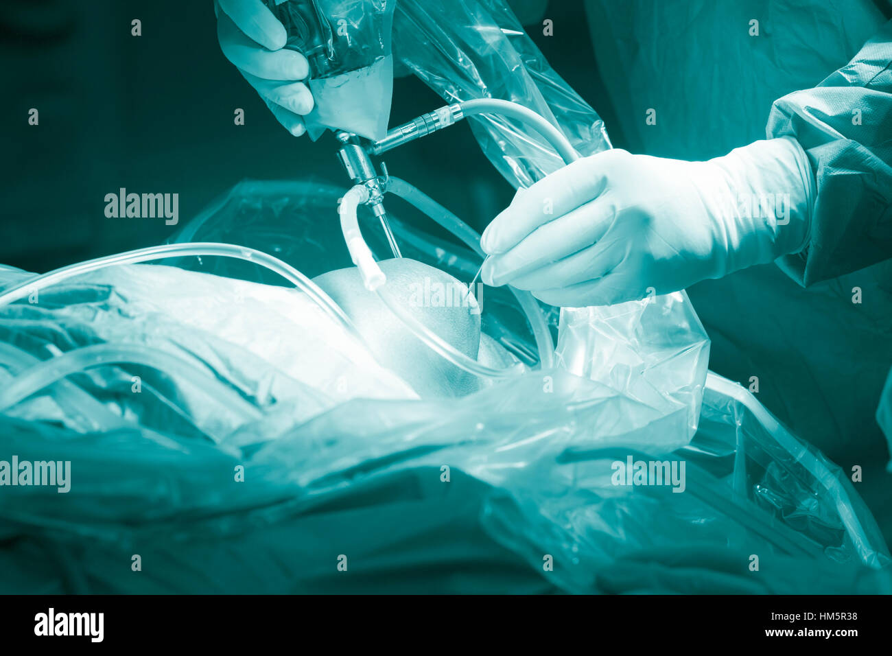 Knee keyhole surgery hospital arthroscopy operation medical procedure ...