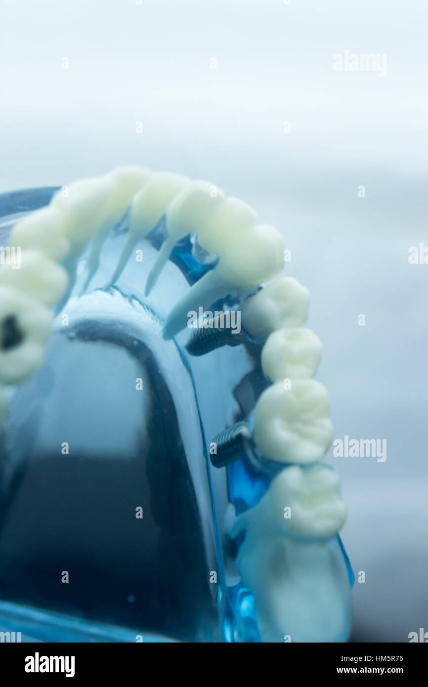 Dental tooth dentistry student learning teaching model showing teeth ...