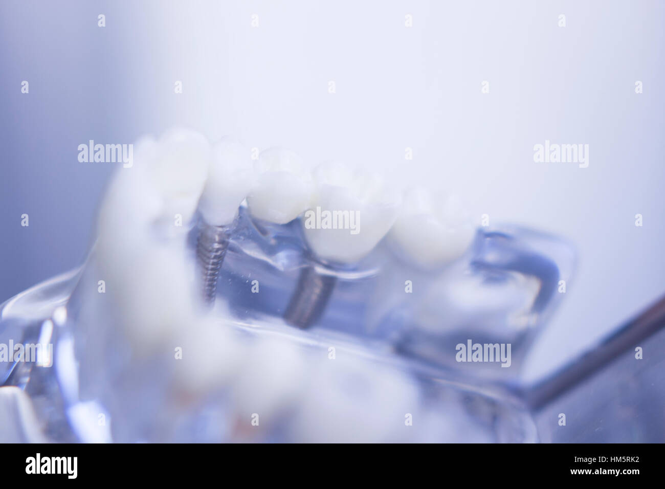 Dentists tooth plastic model used for teaching, learning and patient ...