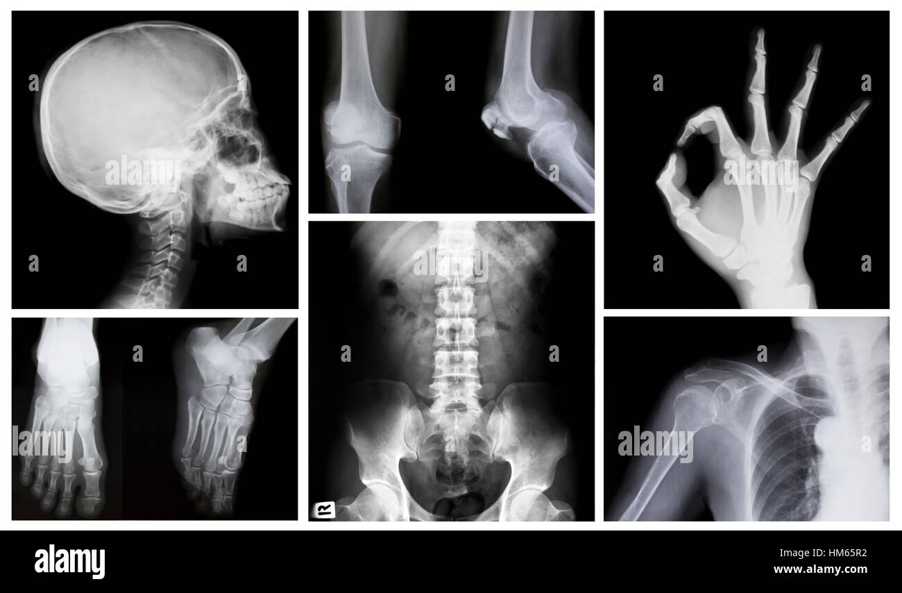 collection of x-ray Stock Photo - Alamy