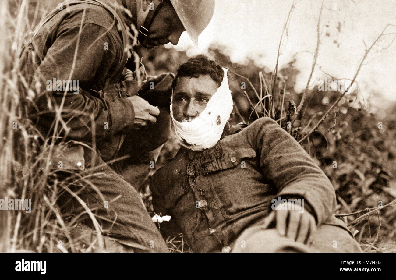 Injured soldier trench wwi hi-res stock photography and images - Alamy