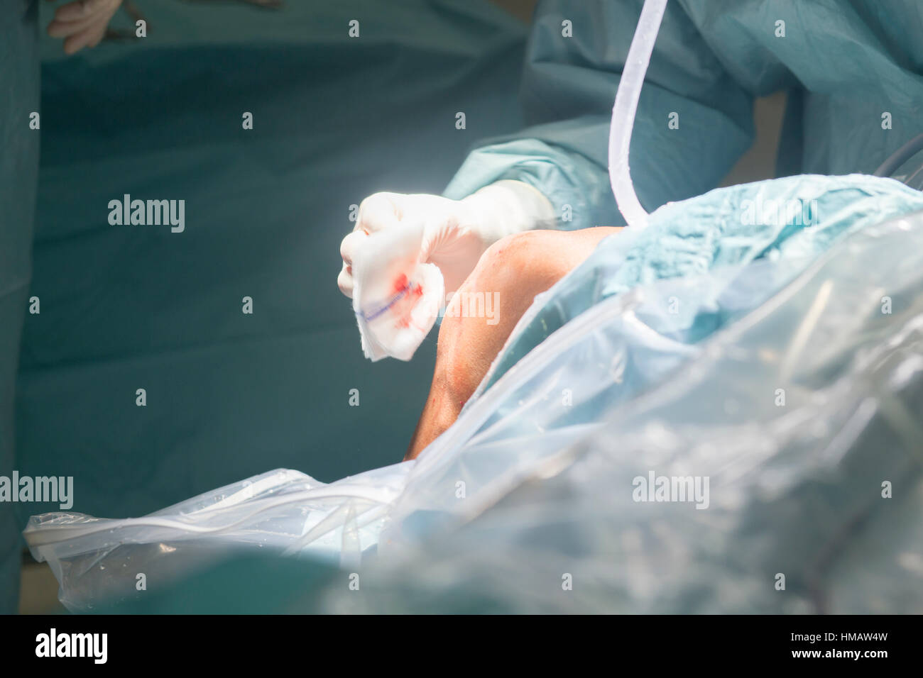 Hospital surgery operating theater emergency room surgical procedure ...