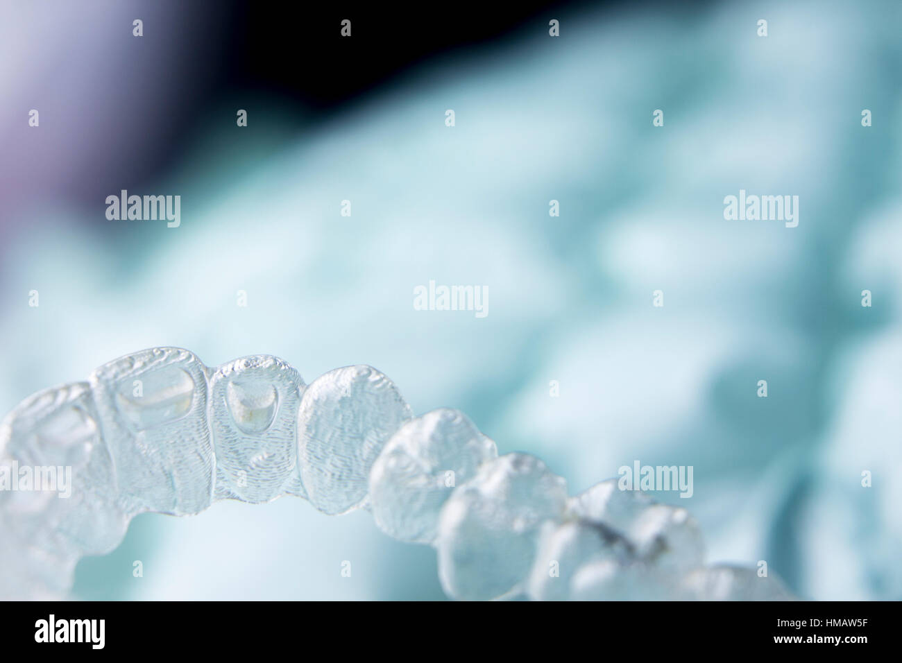 Invisible orthodontics cosmetic brackets tooth aligners plastic braces ...