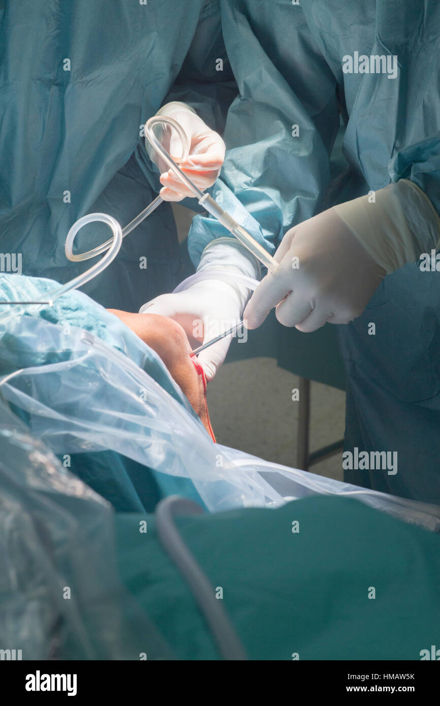 Knee keyhole surgery hospital arthroscopy operation medical procedure ...