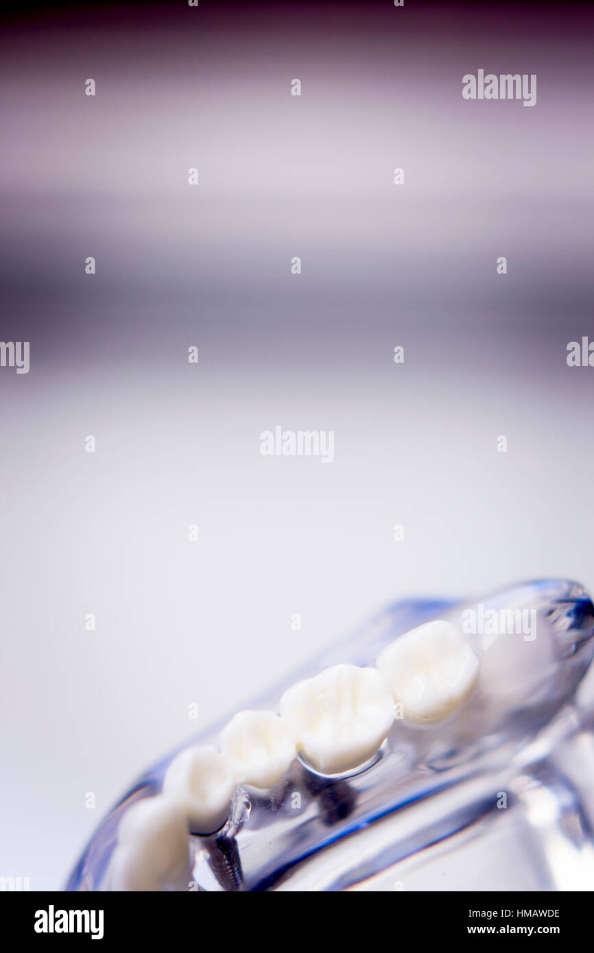 Dentists tooth plastic model used for teaching, learning and patient ...