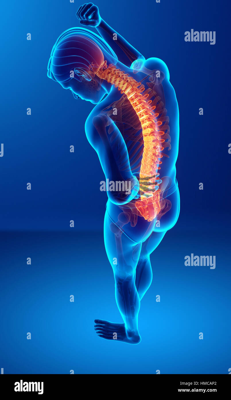 human body anatomy with joint pain Stock Photo - Alamy