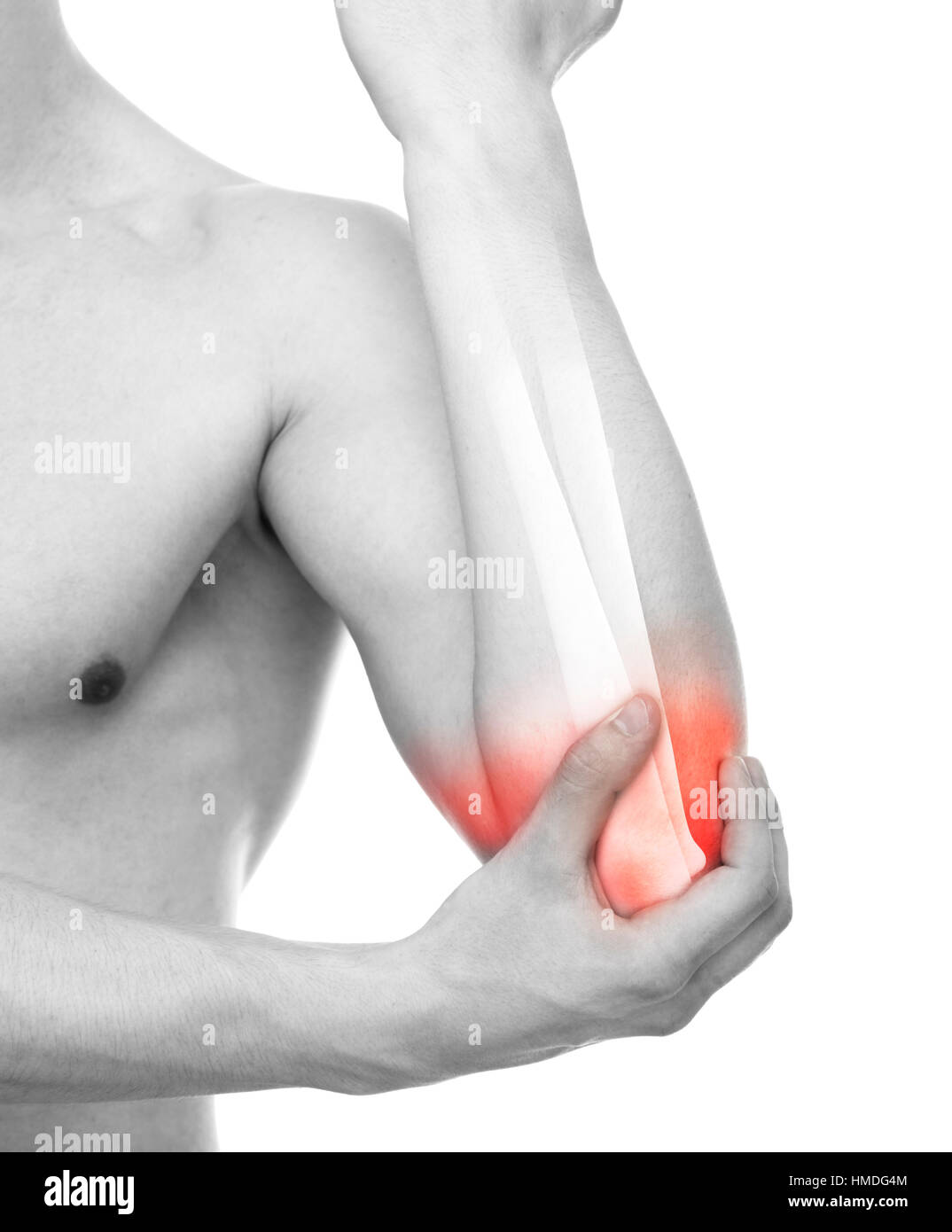 Elbow anatomy hi-res stock photography and images - Alamy