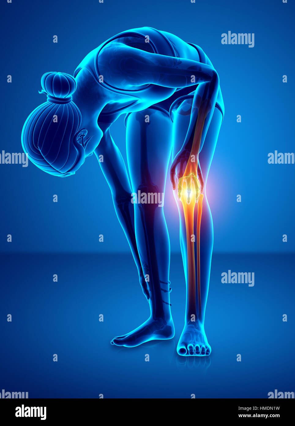 3d Illustration of Women Knee pain Stock Photo - Alamy