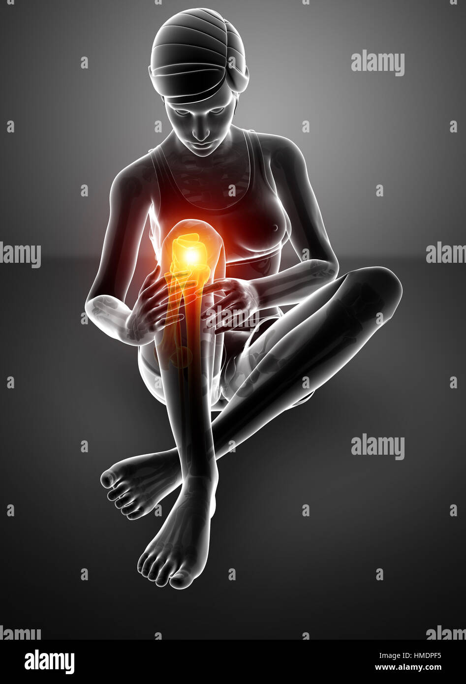3d Illustration of Women Knee pain Stock Photo - Alamy