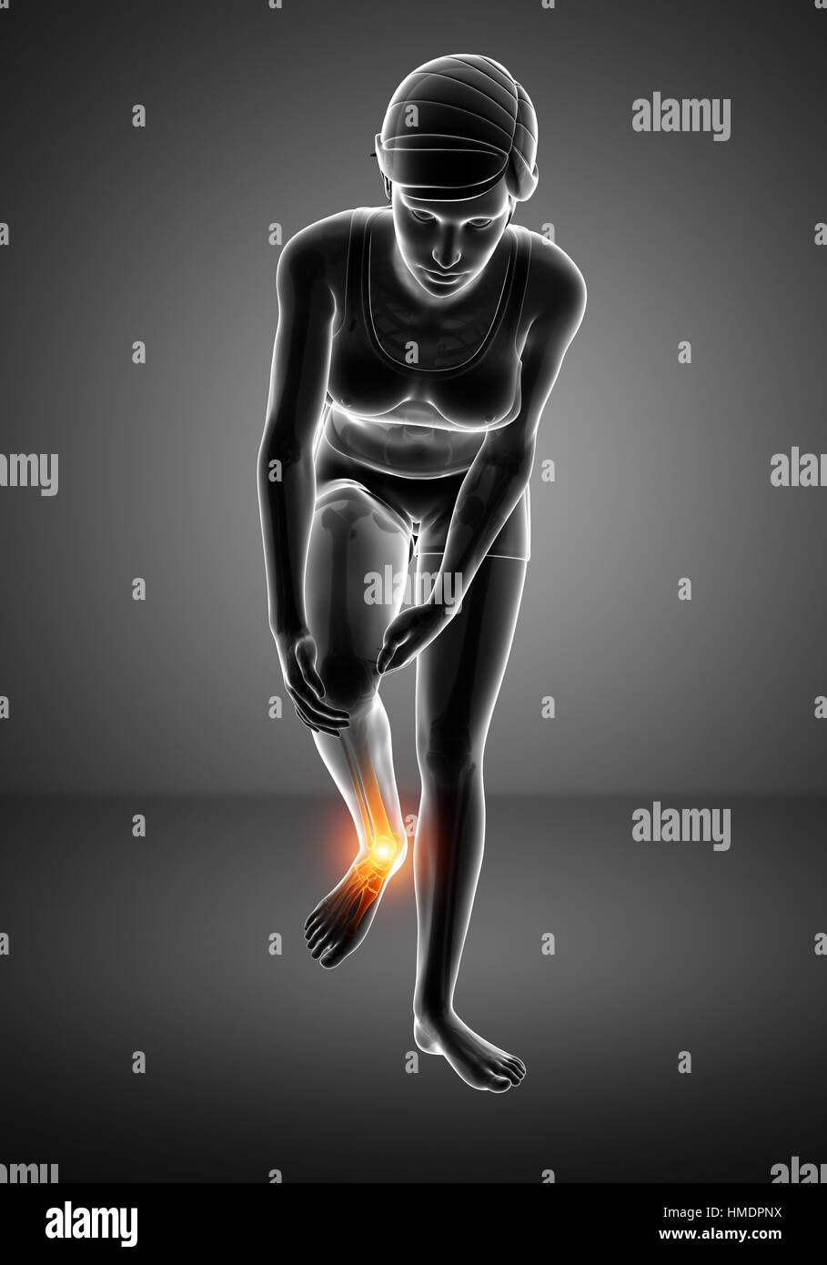 3d illustration of Female foot with ankle pain Stock Photo - Alamy