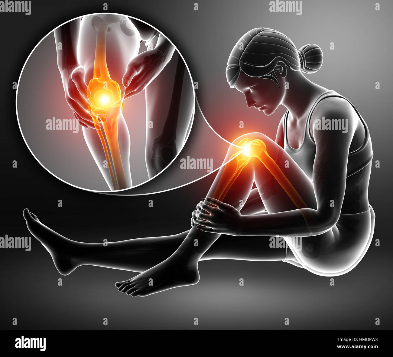 human body anatomy with joint pain Stock Photo - Alamy