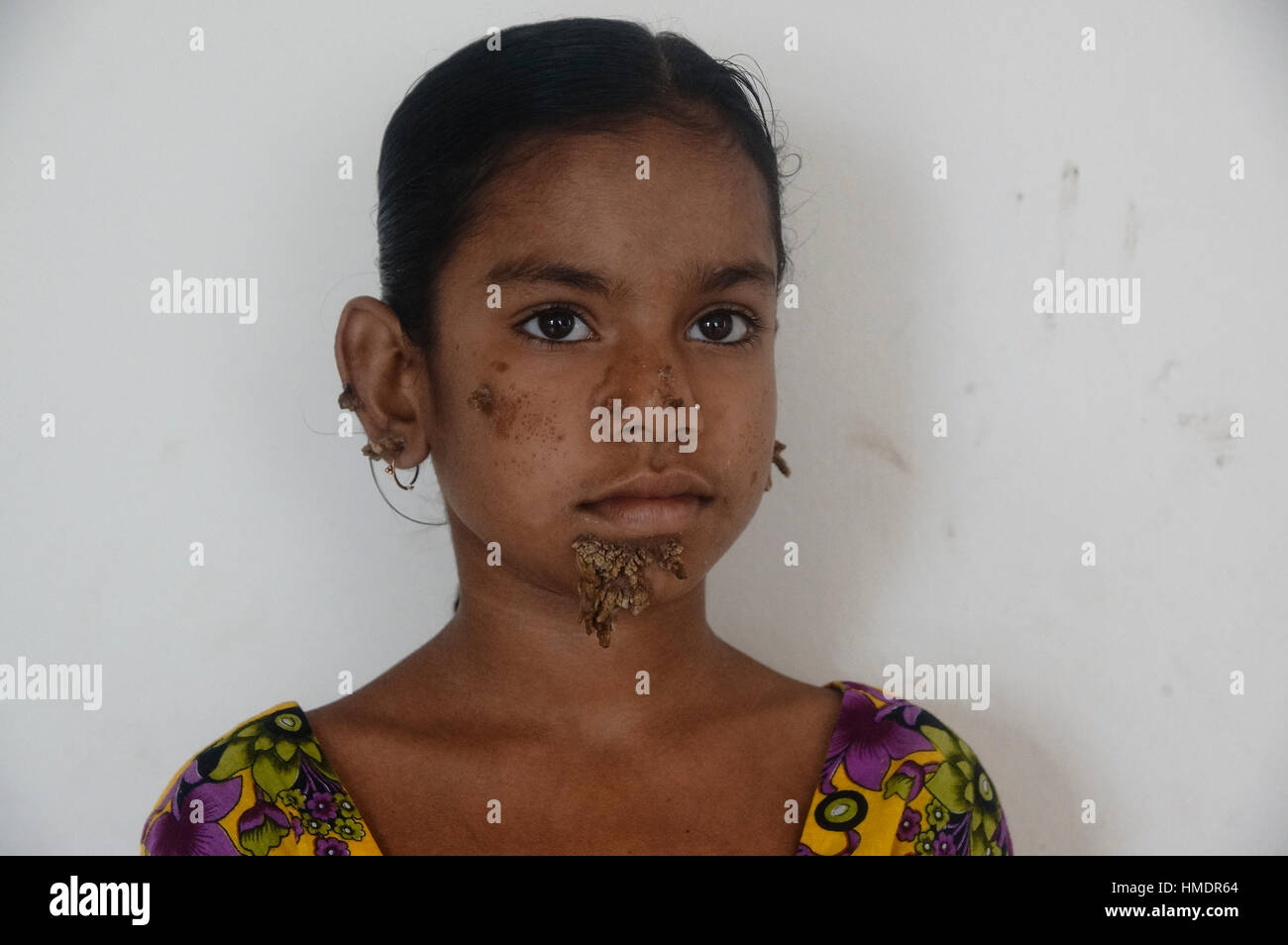 Tree Man Before And After