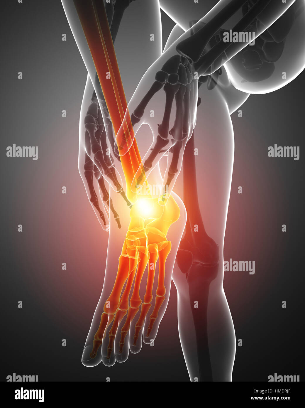 human body anatomy with joint pain Stock Photo - Alamy