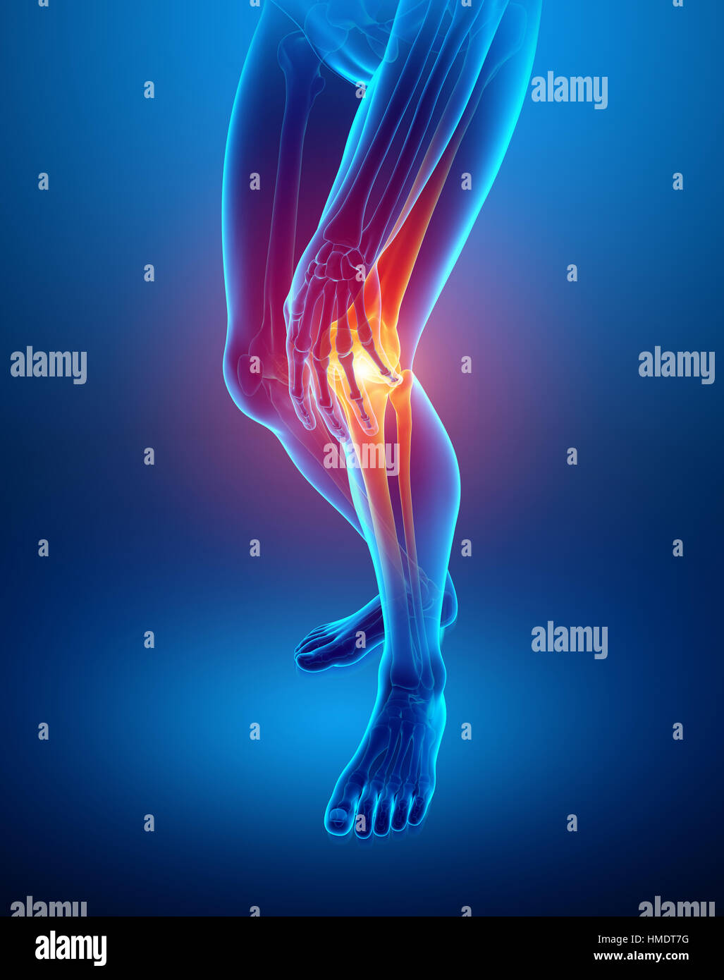 human body anatomy with joint pain Stock Photo - Alamy