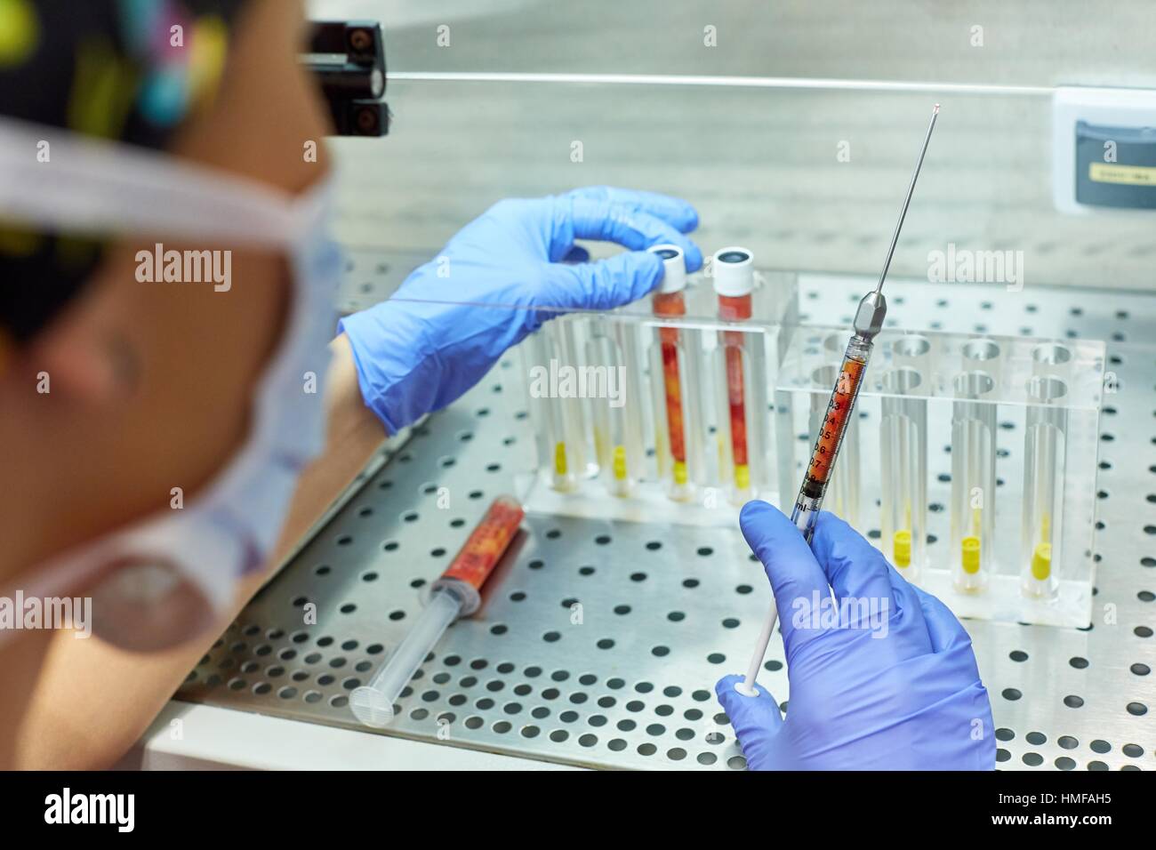 Fat grafting hi-res stock photography and images - Alamy