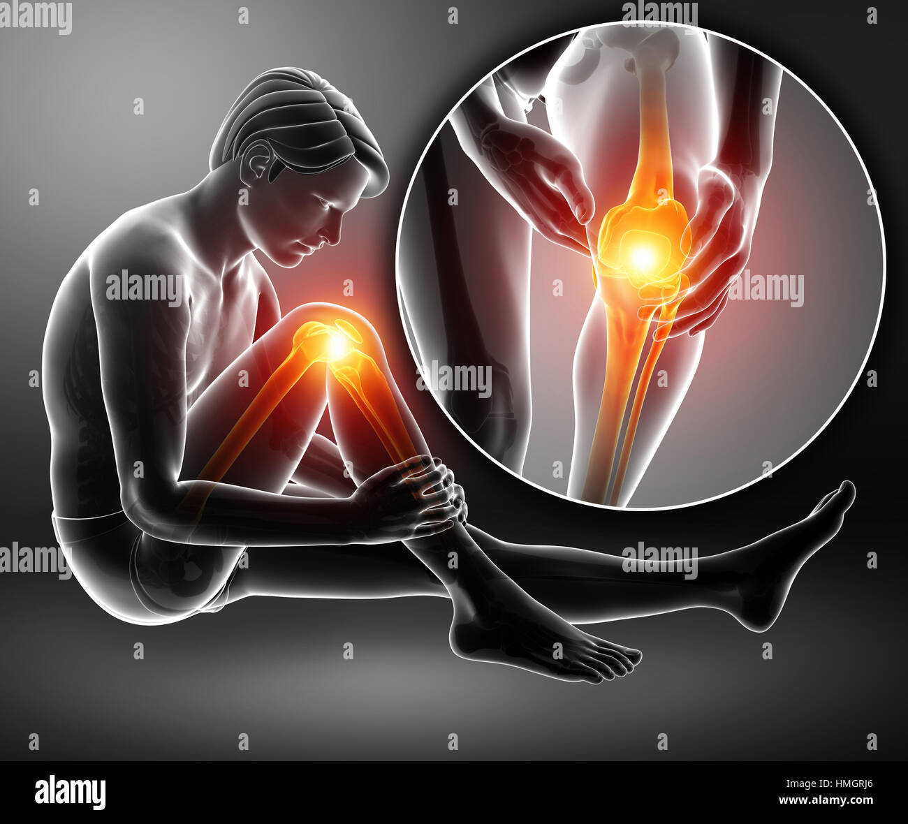 human body anatomy with joint pain Stock Photo - Alamy