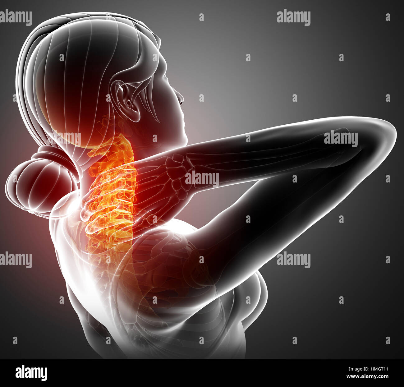 human body anatomy with joint pain Stock Photo - Alamy
