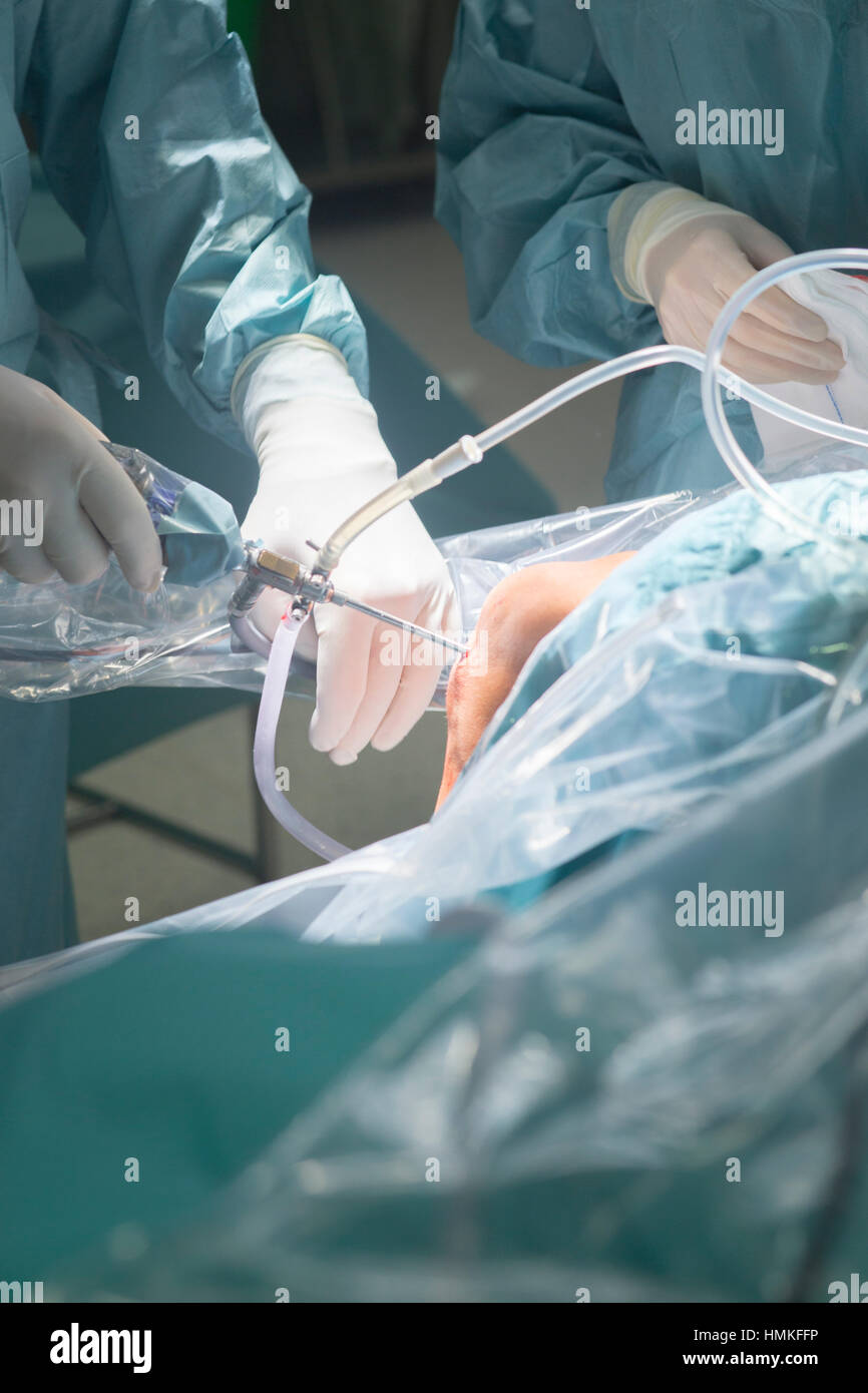 Knee keyhole surgery hospital hi-res stock photography and images - Alamy